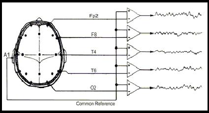 Ad620 Instrumentation Amplifier Pinout Examples Datasheet Features